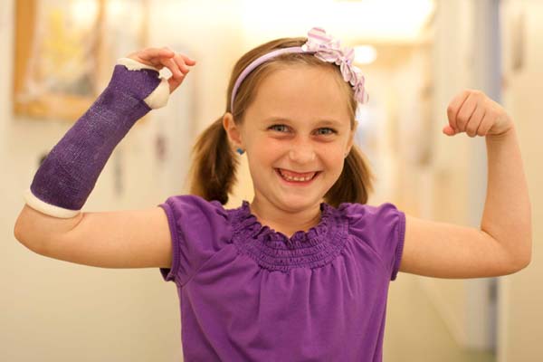 Cast Care Instructions - CHOC